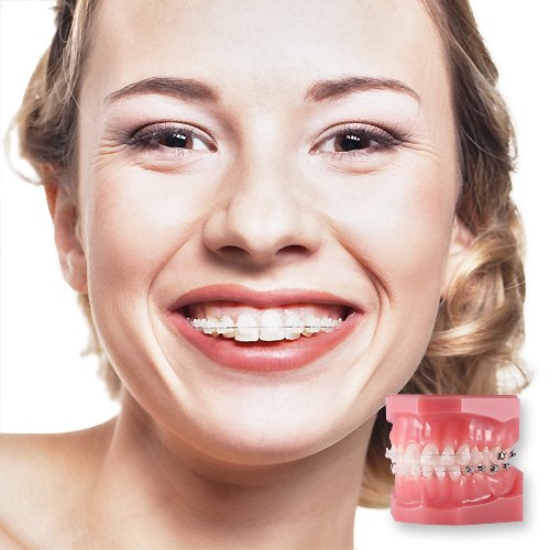 Dr. F. Boldt - Ästhetische Spangen