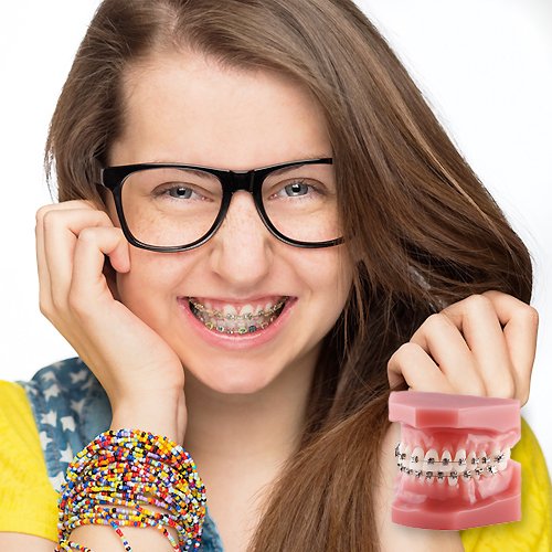 Dr. F. Boldt - feste Spangen